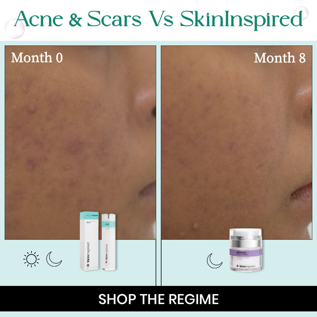 SkinInspired | Luxury Skincare, High-Performance Products