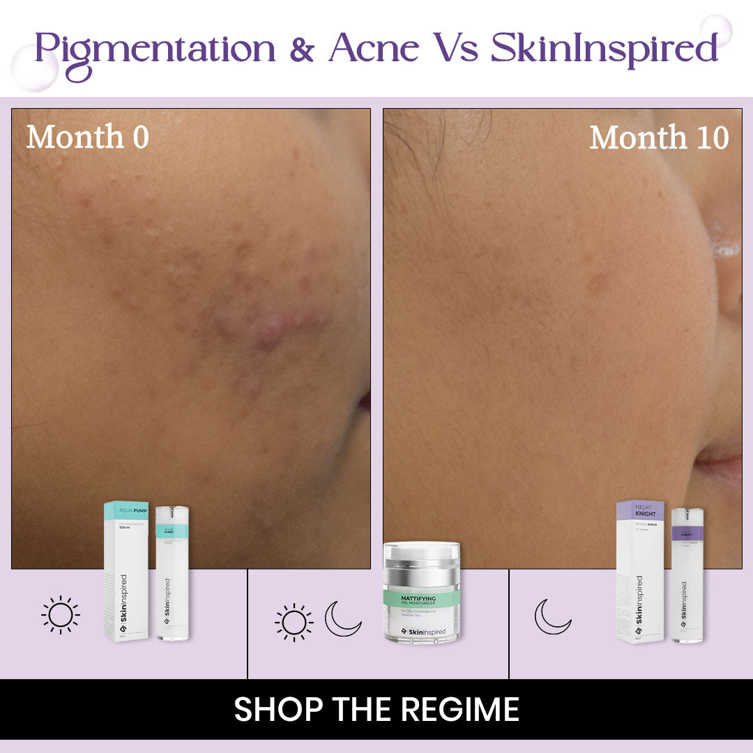 SkinInspired | Luxury Skincare, High-Performance Products