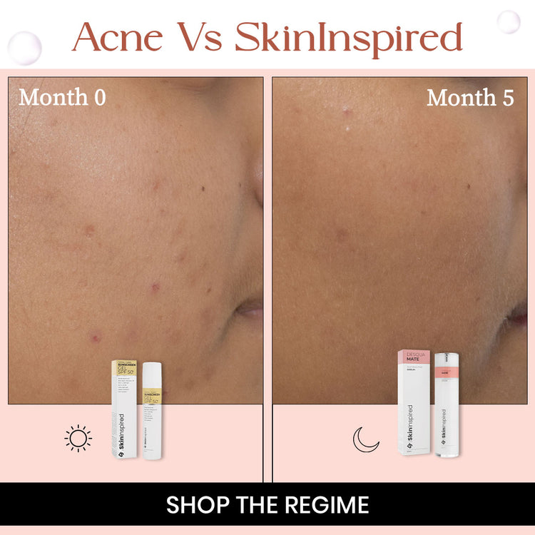 SkinInspired | Luxury Skincare, High-Performance Products